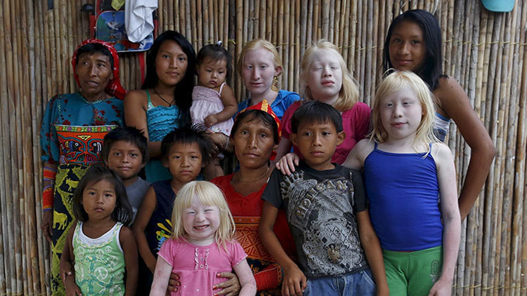 Hijos de la Luna: Cientos de niños albinos nacen en un pueblo indígena ...