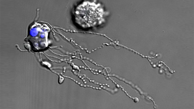 Captan por primera vez las etapas de la muerte de una célula humana - RT