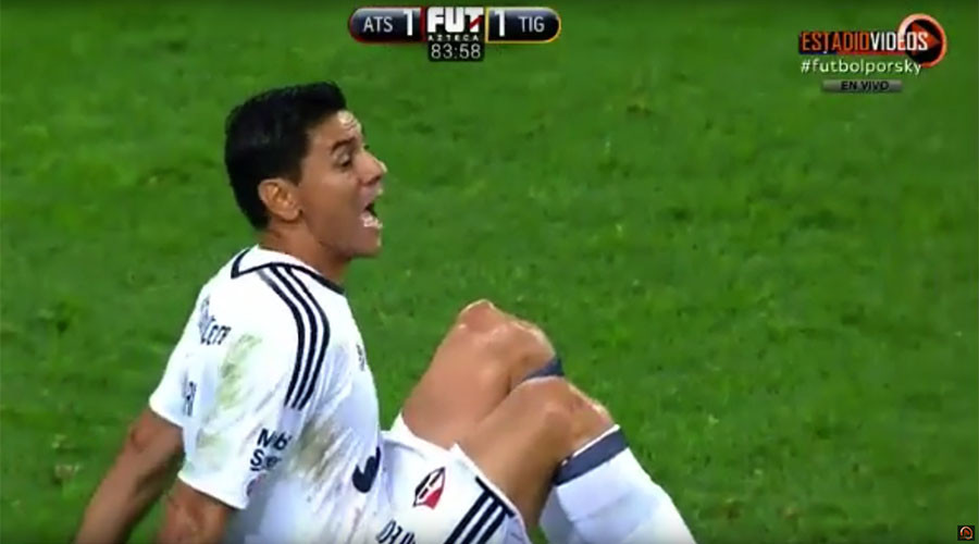 Eye-popping: Horror as goalkeeper suffers freak knee injury (GRAPHIC ...