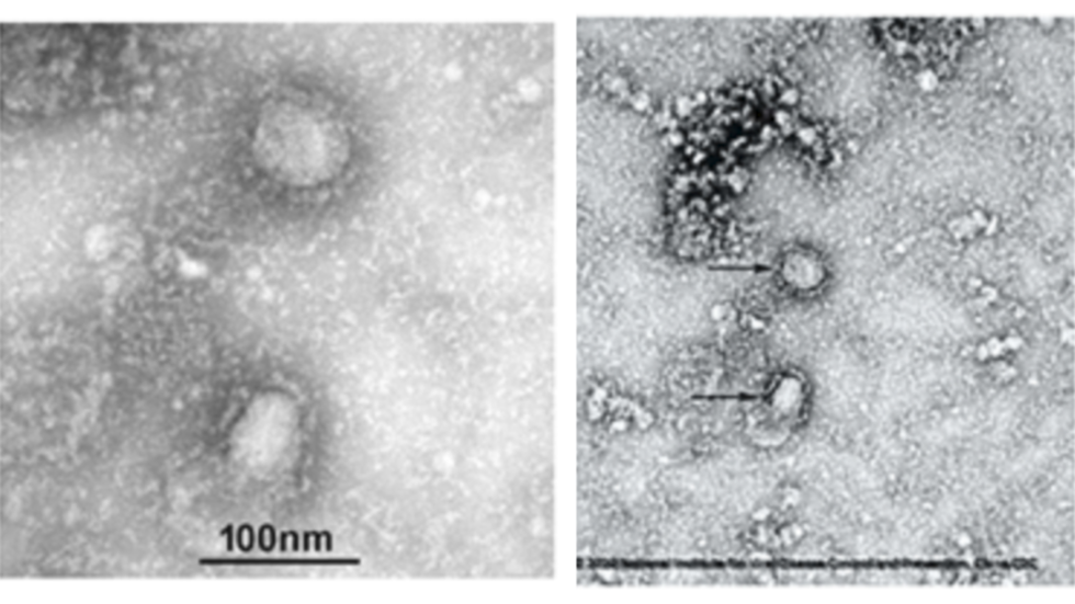 Chinese authorities share first PHOTOS of deadly CORONAVIRUS — RT World ...