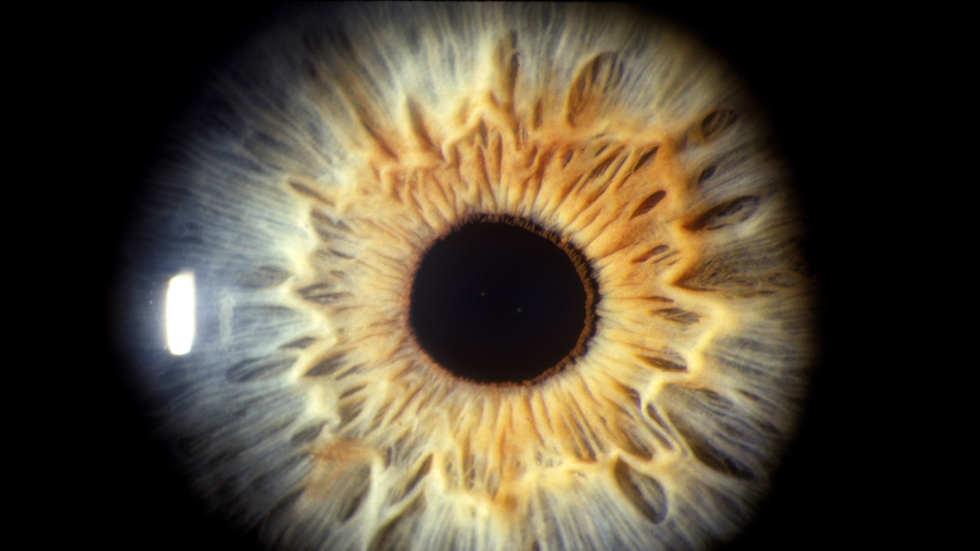 Bright eyes? People with larger pupils are ‘smarter’ than those with ...